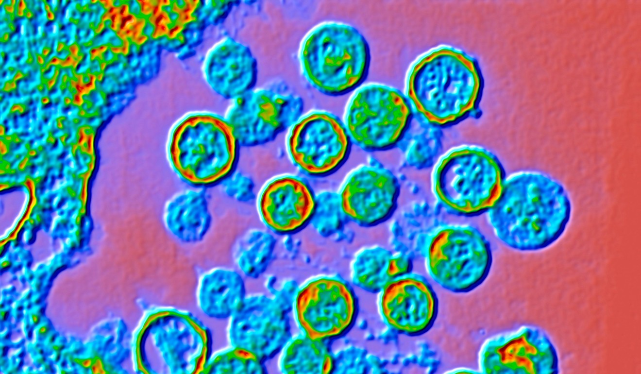 Seven of the most deadly viruses, from Ebola to rabies – hidden killers ...